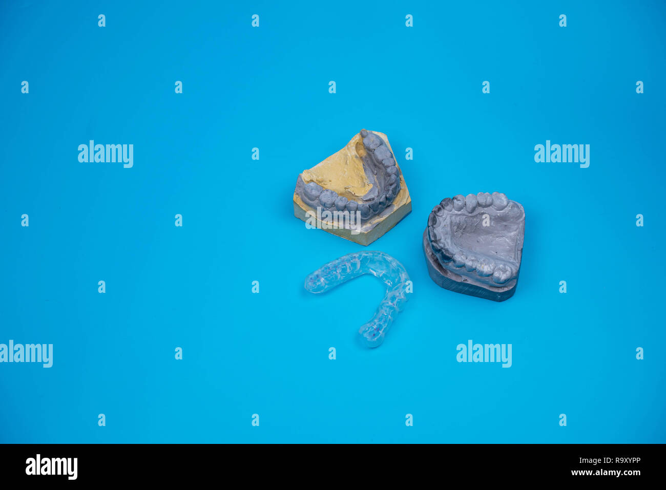 Molds of the jaw. dental splint. Dental implants on blue background ...