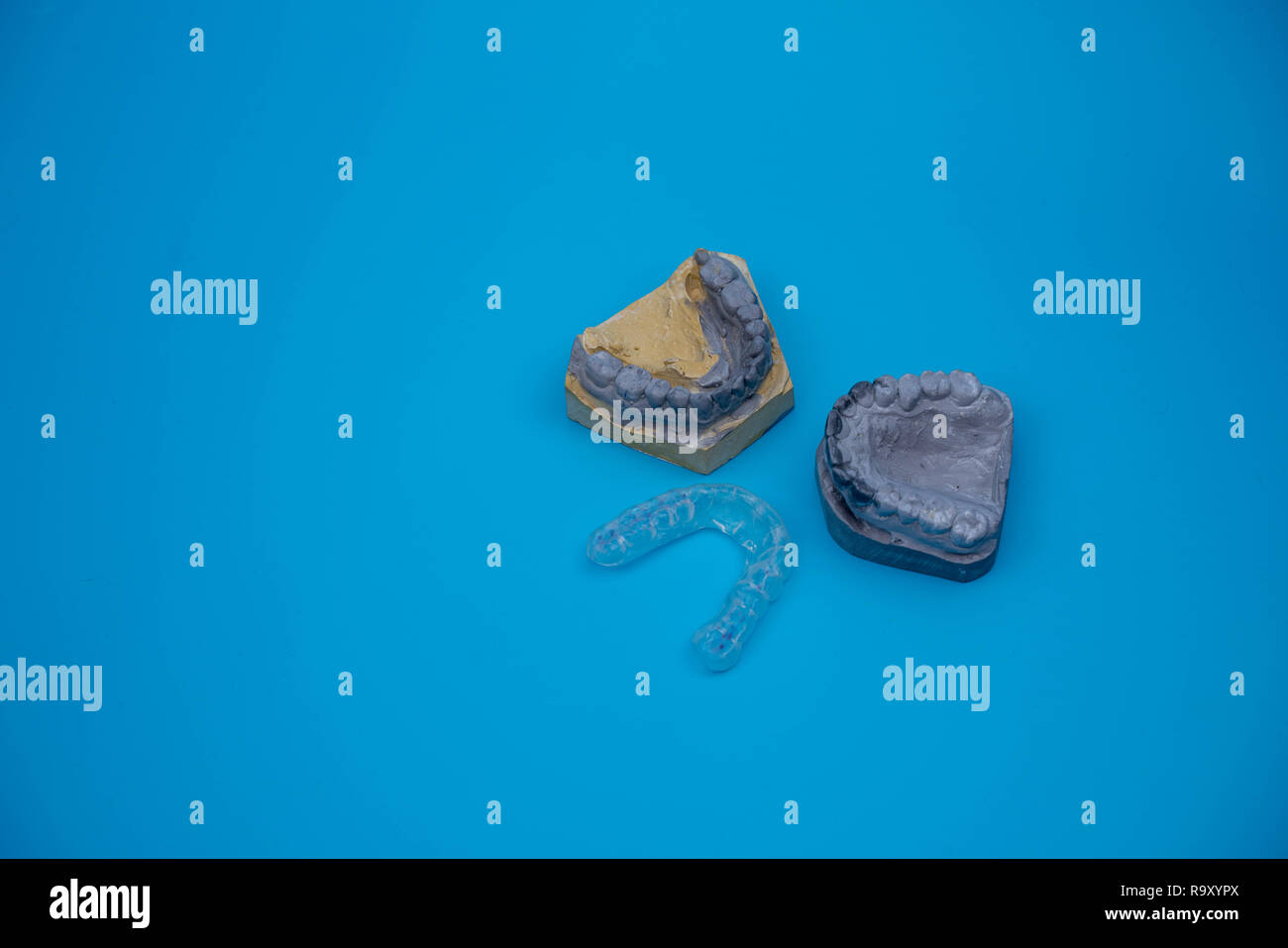 Molds of the jaw. dental splint. Dental implants on blue background ...