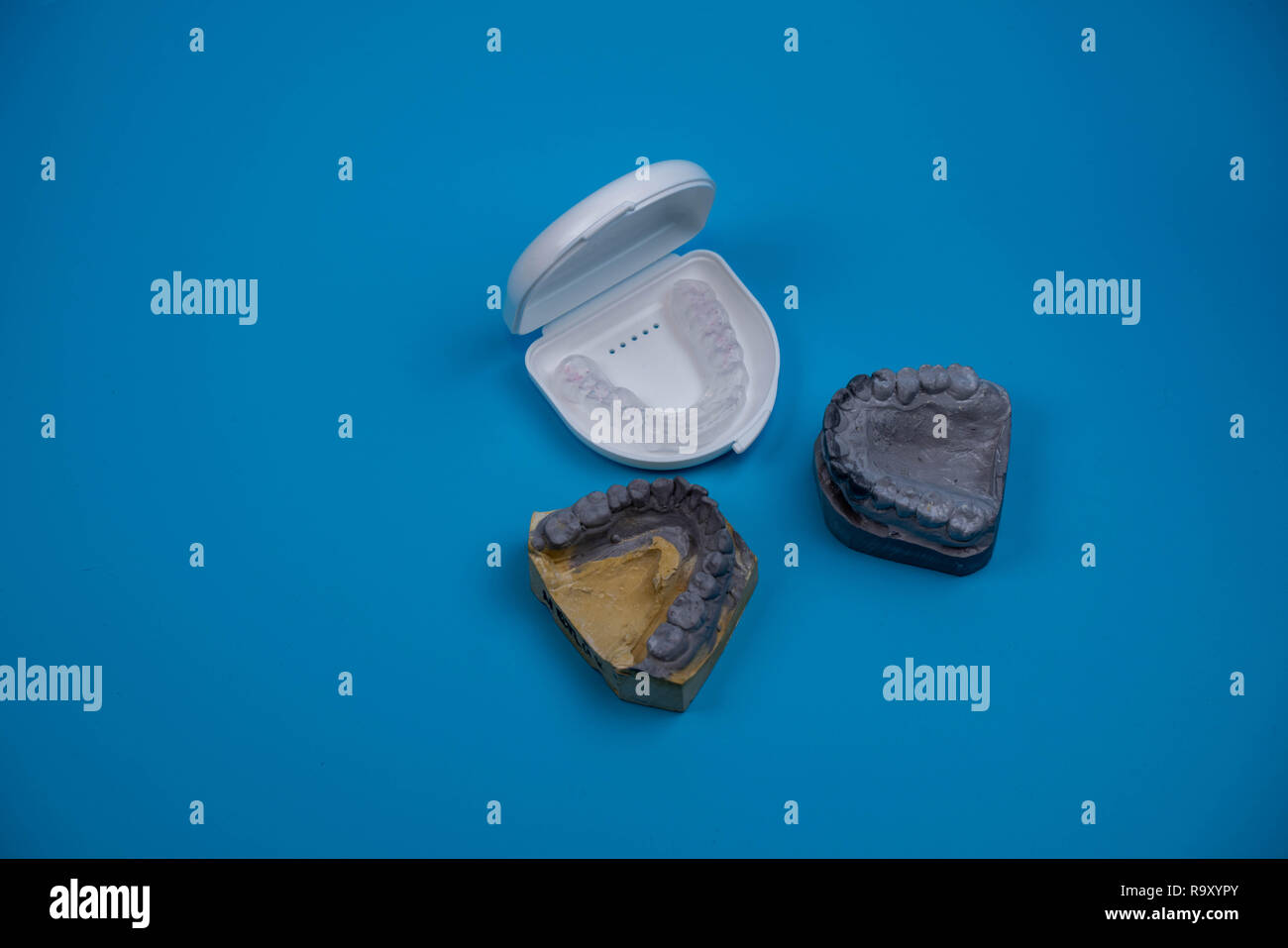 Molds of the jaw. dental splint. Dental implants on blue background ...