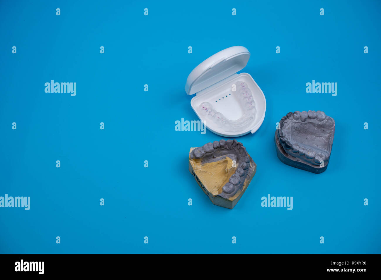 Molds of the jaw. dental splint. Dental implants on blue background ...