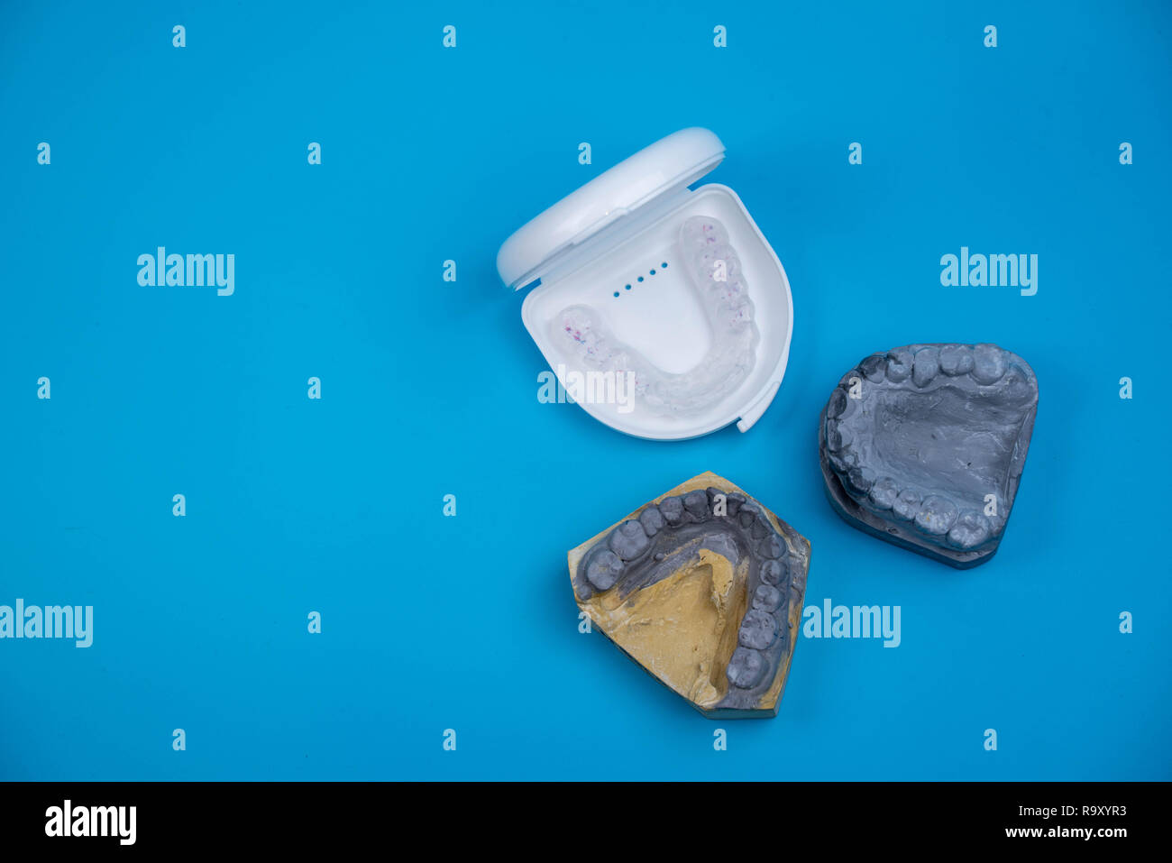 Molds of the jaw. dental splint. Dental implants on blue background ...