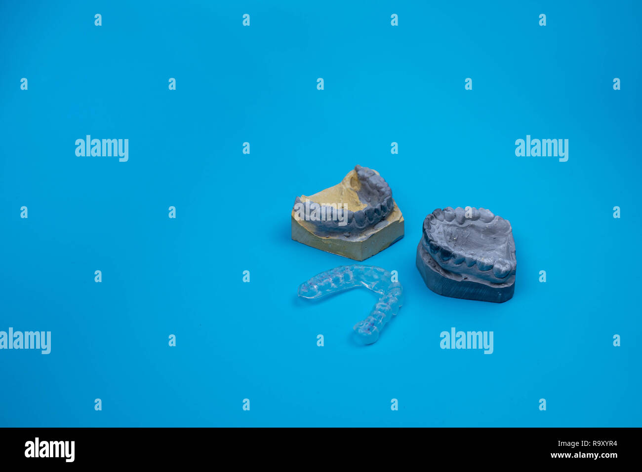 Molds of the jaw. dental splint. Dental implants on blue background ...