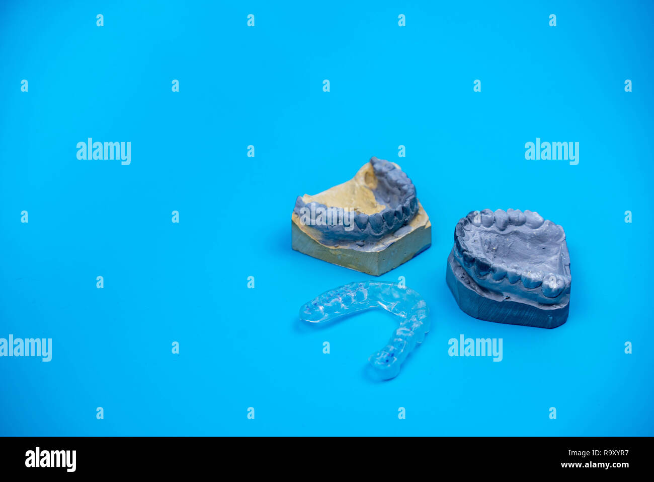 Molds of the jaw. dental splint. Dental implants on blue background ...
