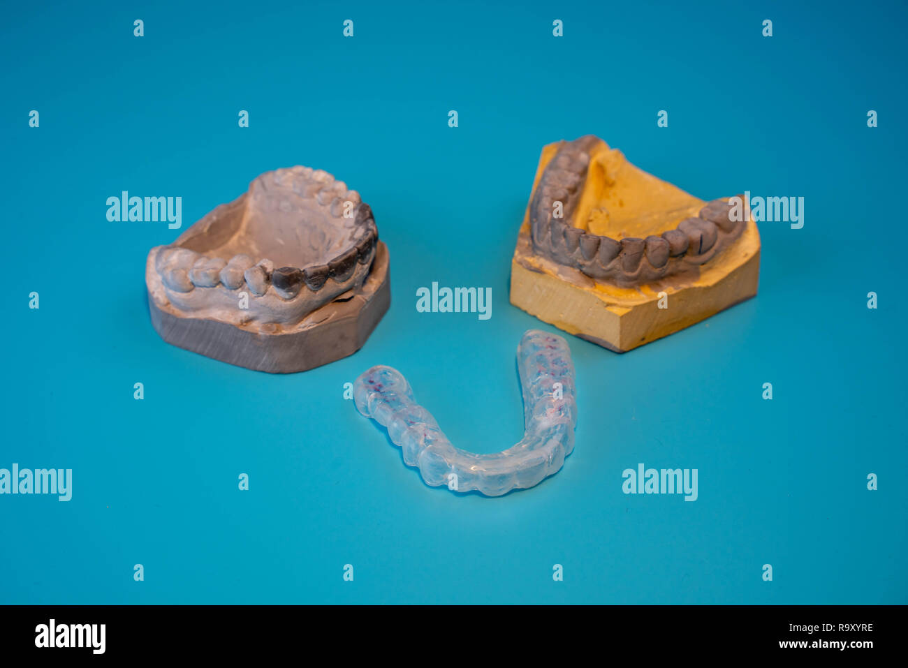 Dental splint hi-res stock photography and images - Alamy
