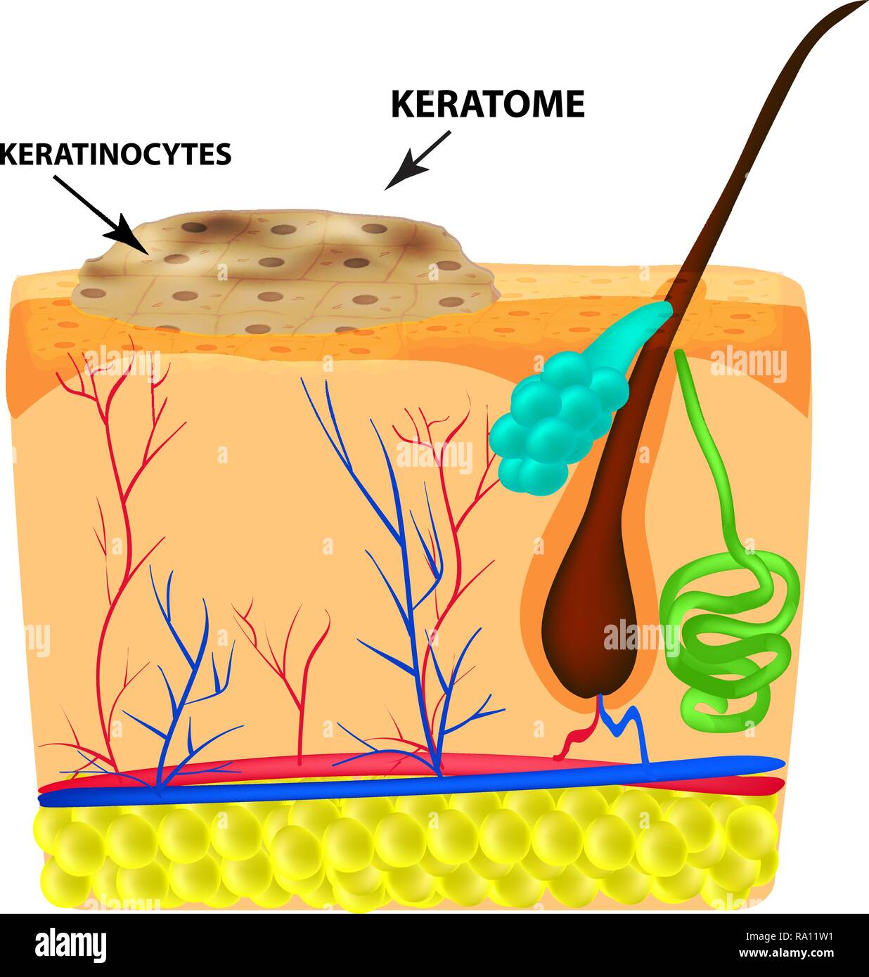 Keratoma Skin