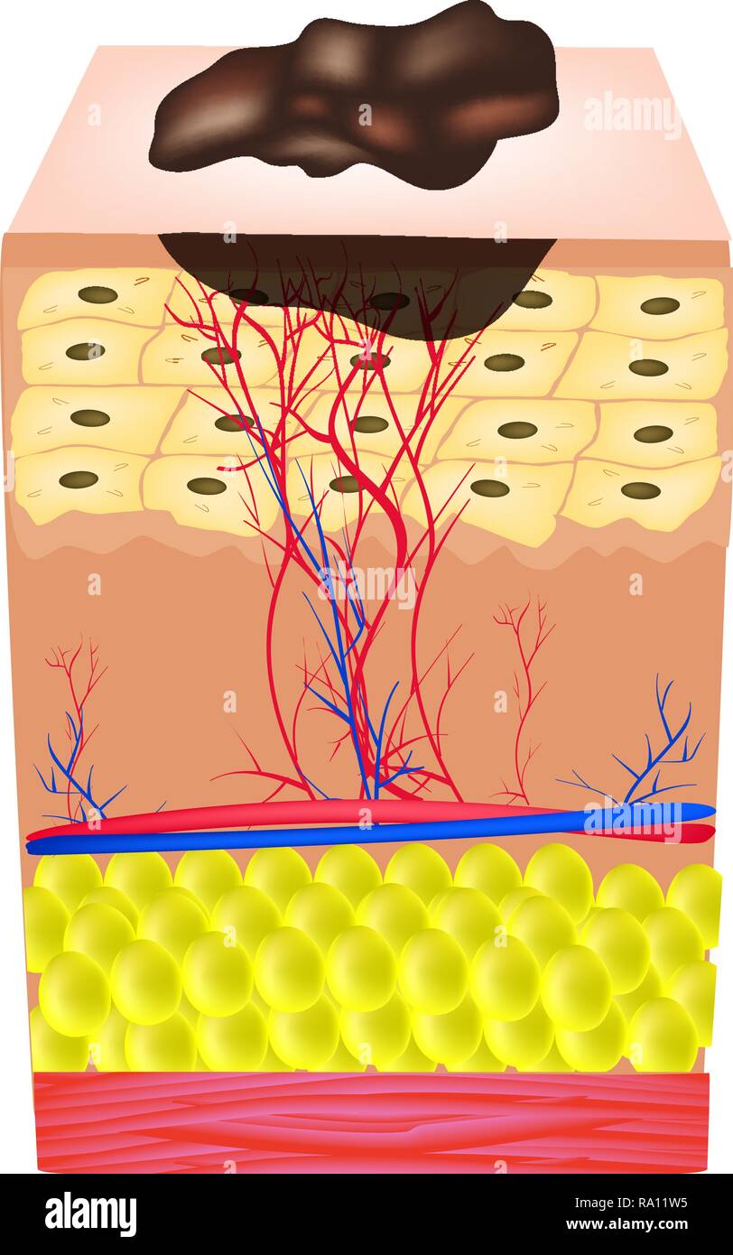 What moles do Stock Vector Images - Alamy