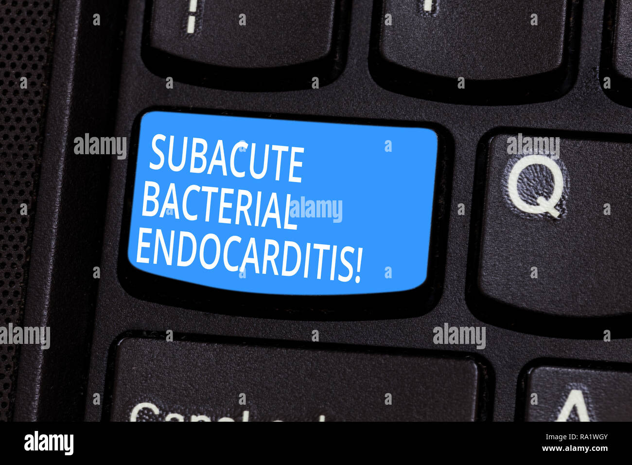 Infective endocarditis hi-res stock photography and images - Alamy