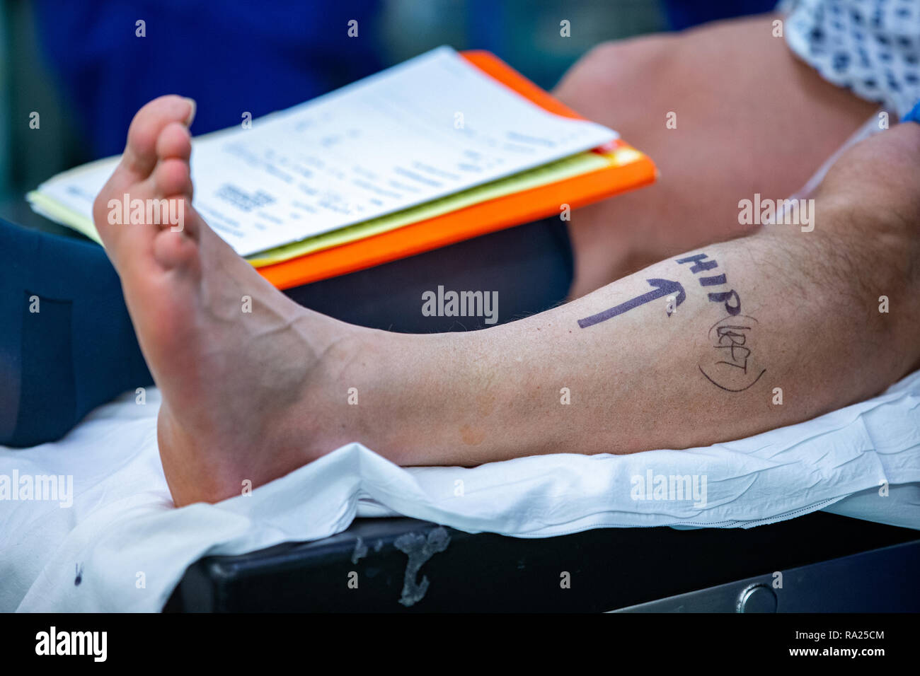 Hip replacement hi-res stock photography and images - Alamy