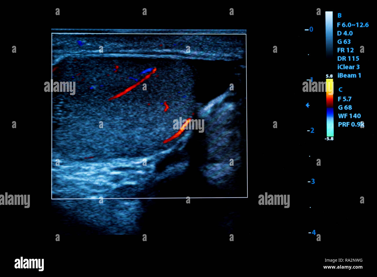 Colourful image of modern ultrasound monitor. Ultrasonography machine ...