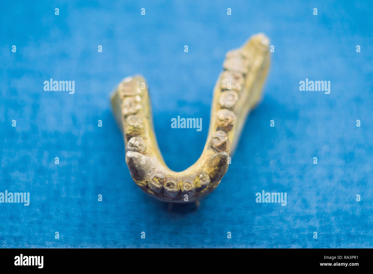 Teeth of an ancient man. Human evolution is the evolutionary process ...