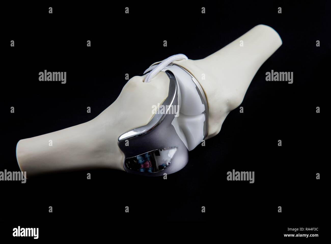 Knee prosthesis, knee endoprosthesis or knee joint prosthesis, on a ...