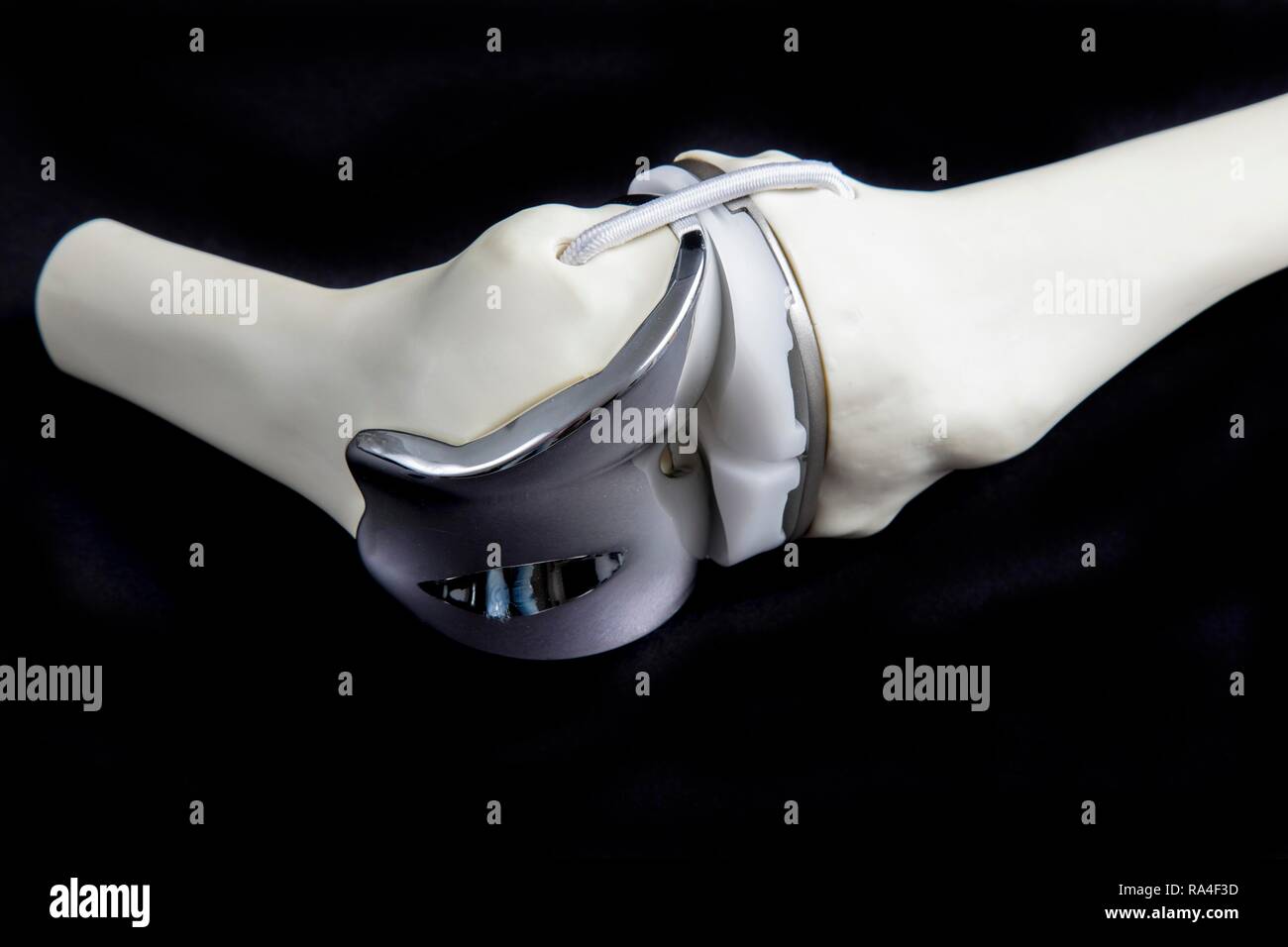 Knee prosthesis, knee endoprosthesis or knee joint prosthesis, on a ...