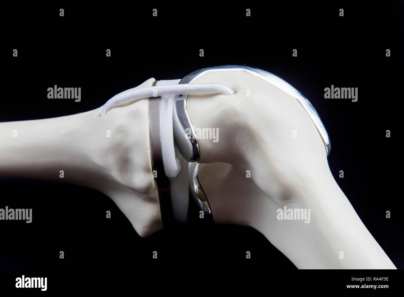 Knee prosthesis, knee endoprosthesis or knee joint prosthesis, on a ...