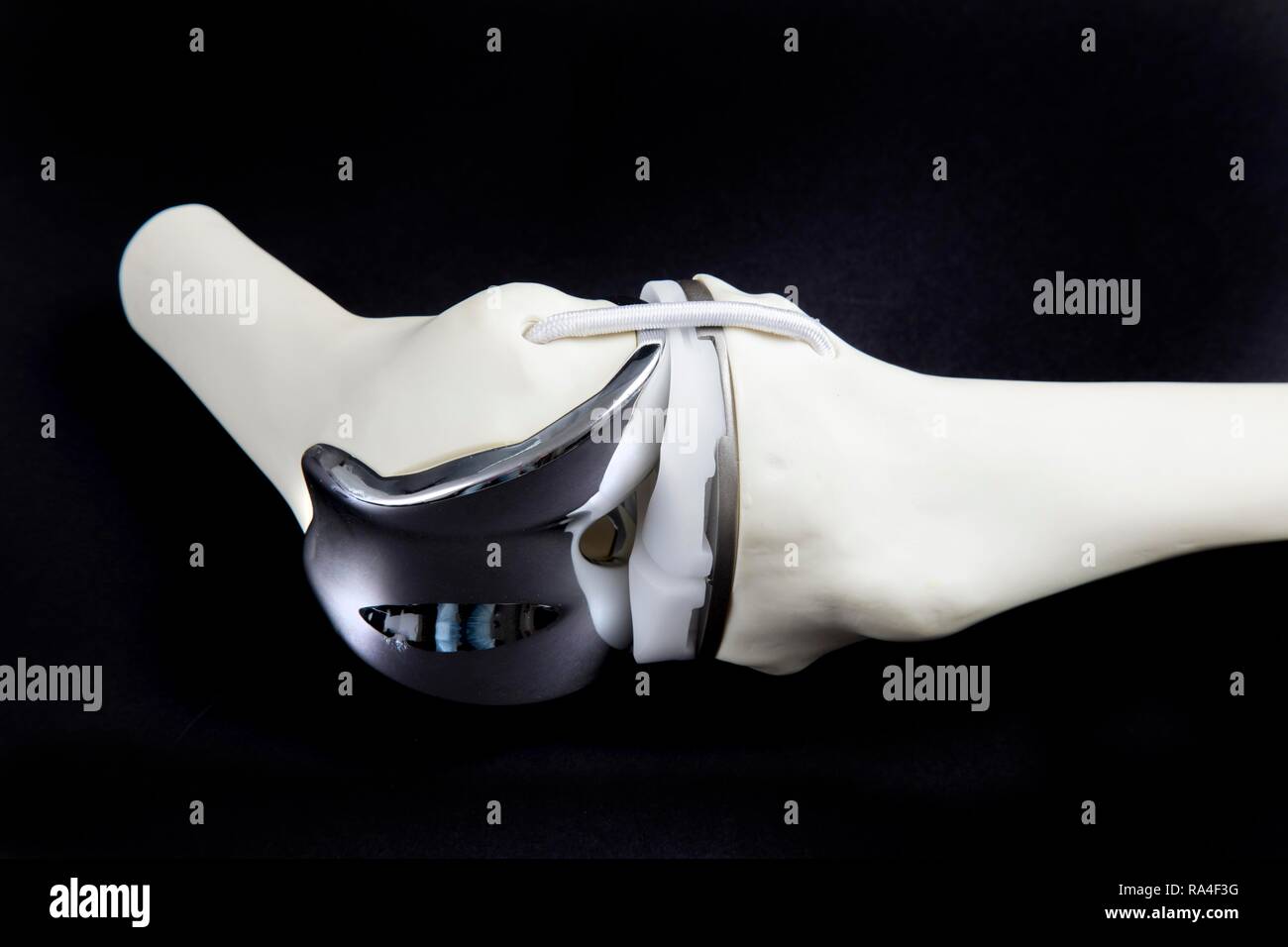 Knee prosthesis, knee endoprosthesis or knee joint prosthesis, on a ...