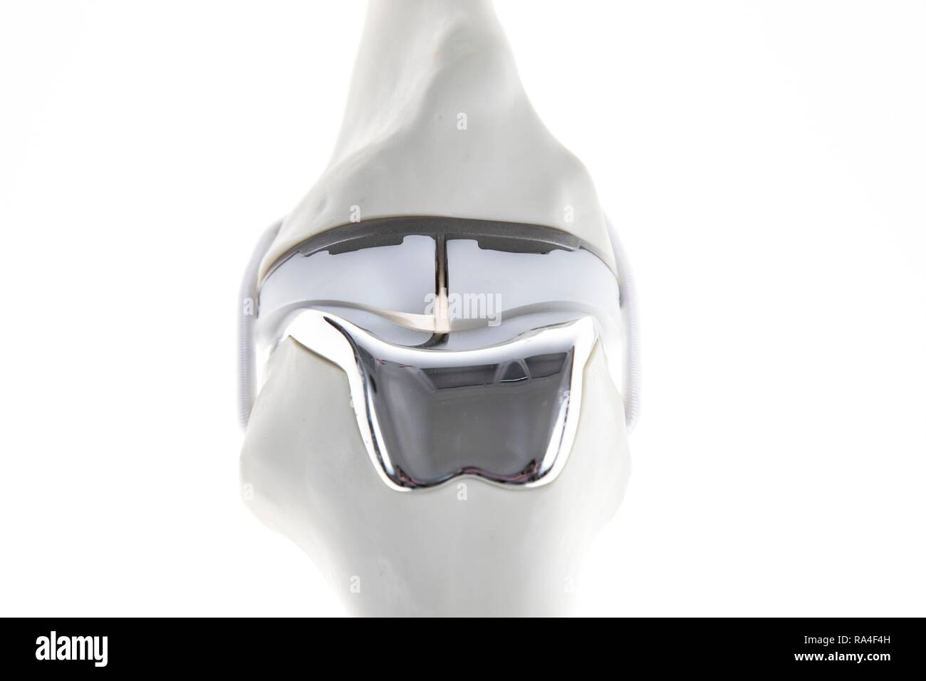 Knee prosthesis, knee endoprosthesis or knee joint prosthesis, on a ...