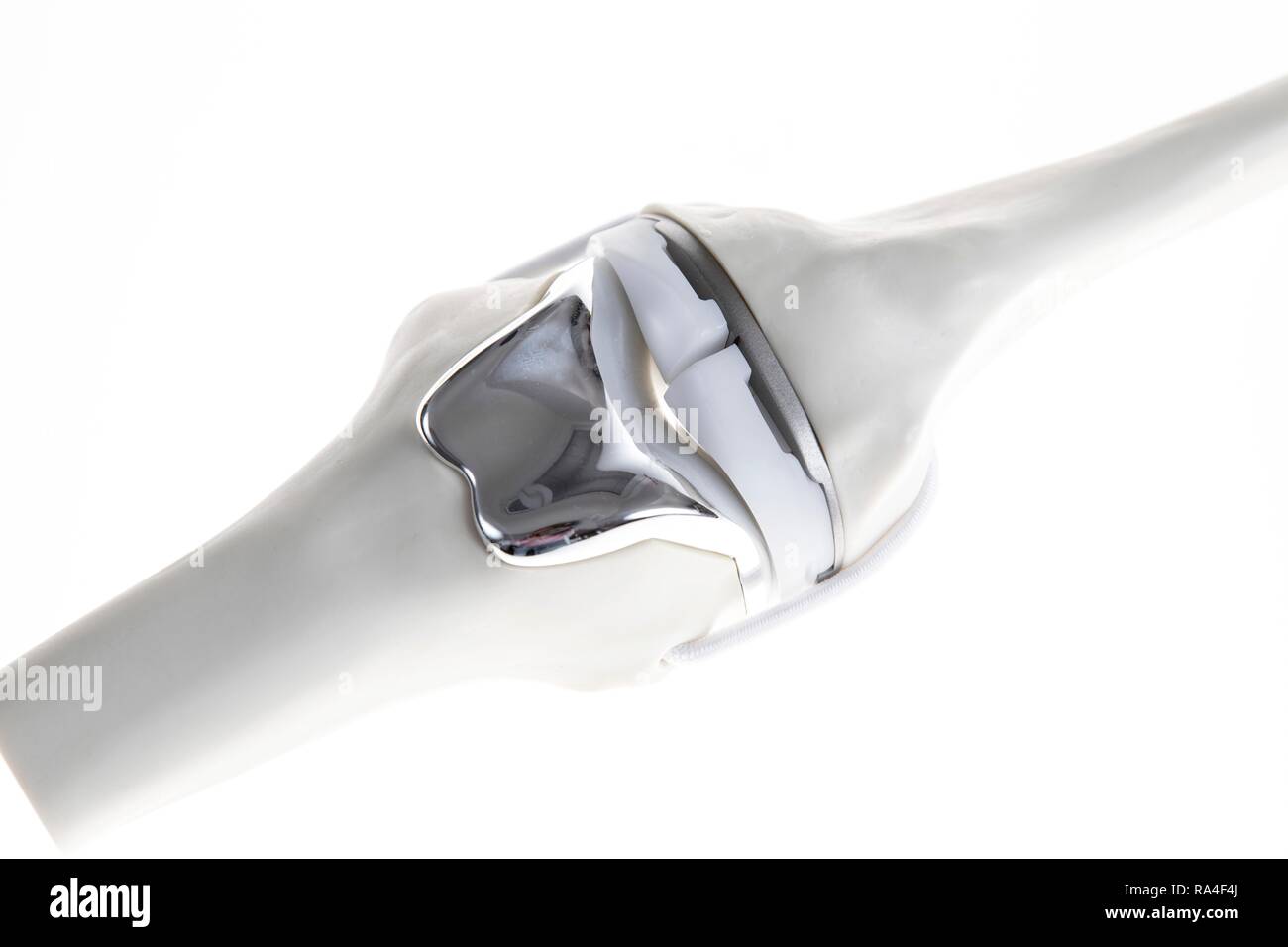 Knee prosthesis, knee endoprosthesis or knee joint prosthesis, on a ...