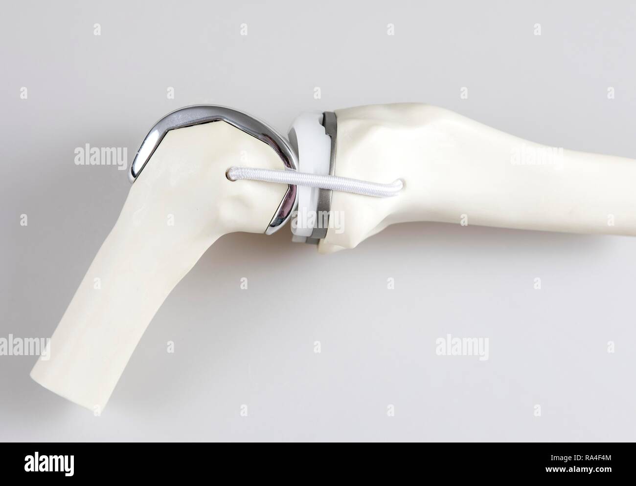 Knee prosthesis, knee endoprosthesis or knee joint prosthesis, on a ...