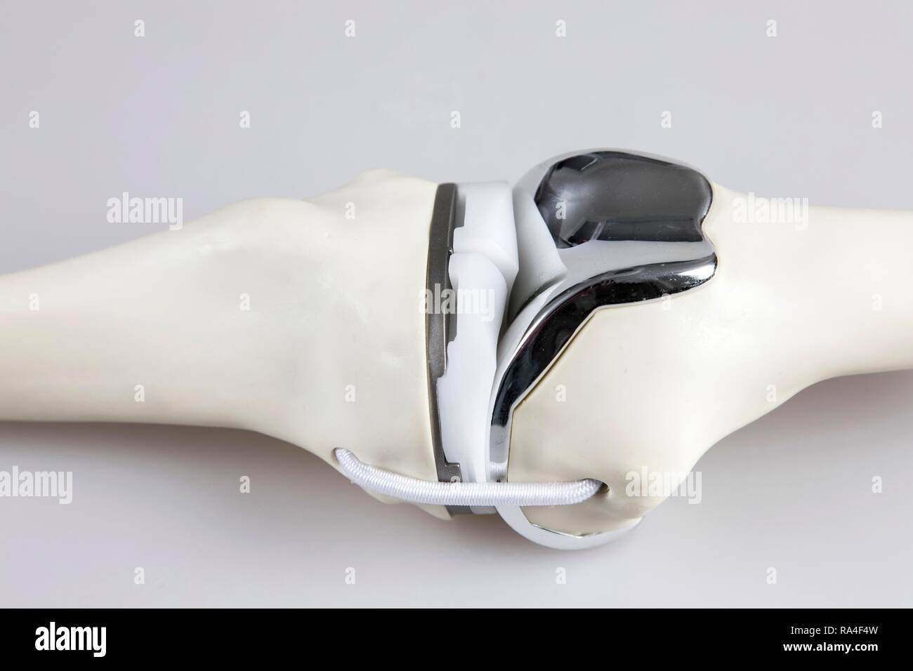 Knee prosthesis, knee endoprosthesis or knee joint prosthesis, on a ...