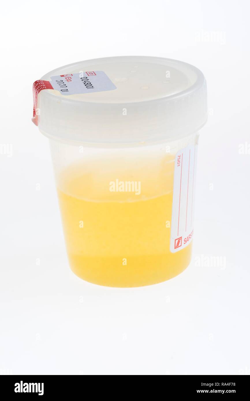 Sample beakers, for urine samples Stock Photo - Alamy