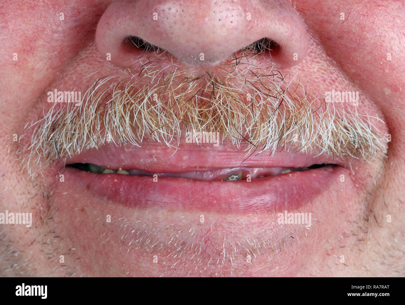 Toothless old man hi-res stock photography and images - Alamy