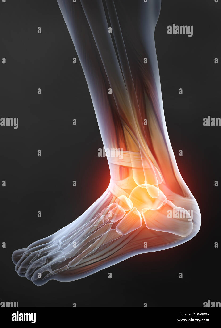 Osteoarthritis, painful ankle joint Stock Photo - Alamy