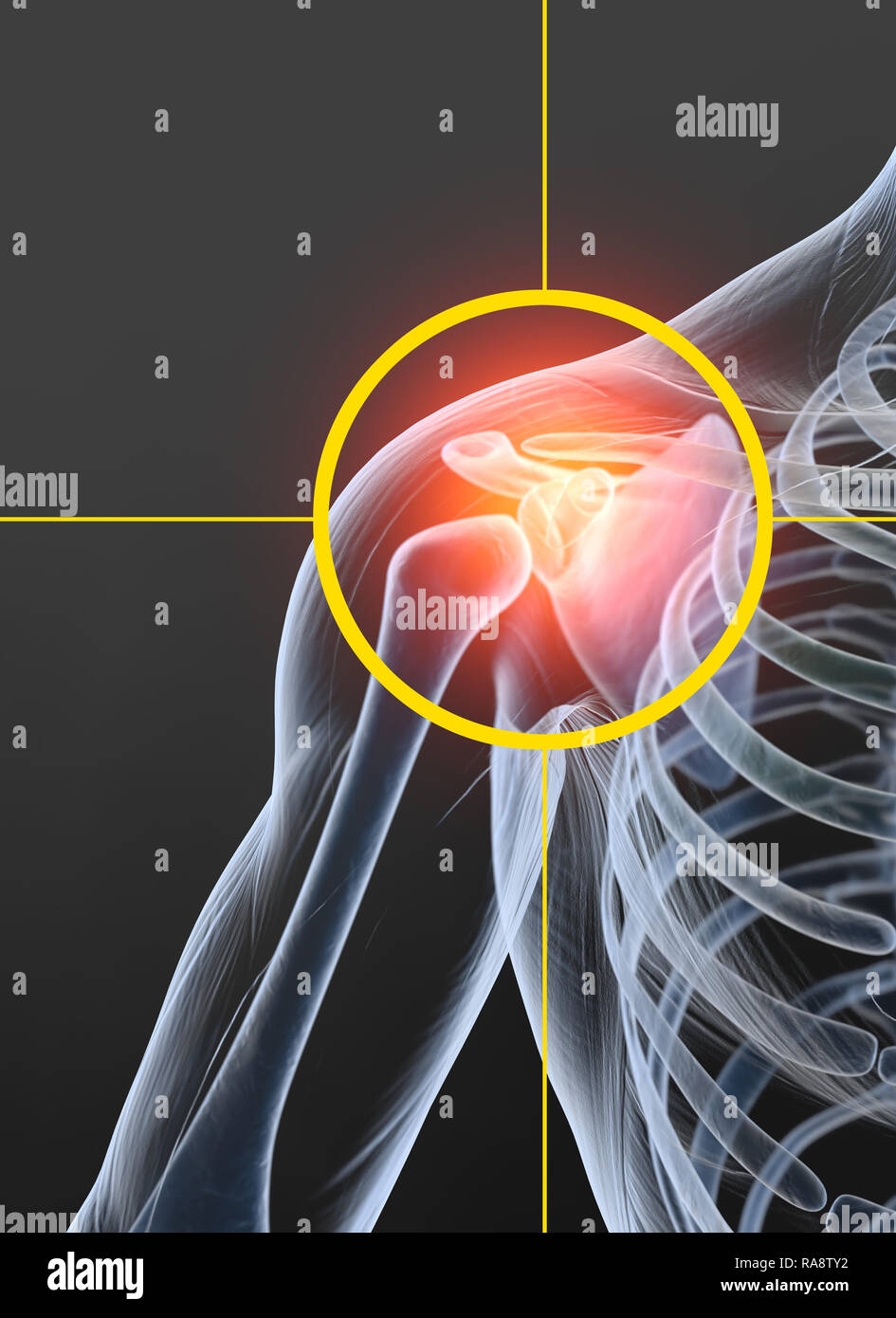 Shoulder joint hi-res stock photography and images - Alamy