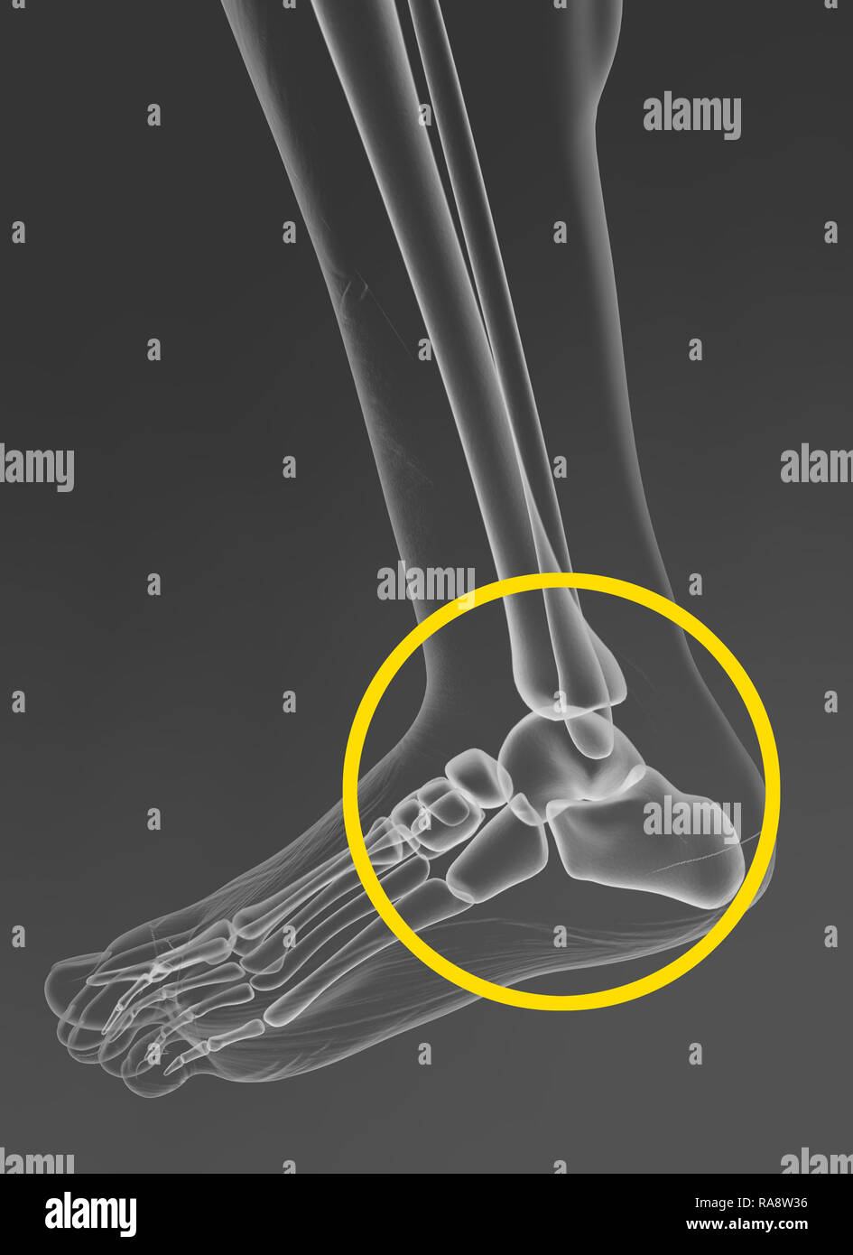 Osteoarthritis ankle hi-res stock photography and images - Alamy