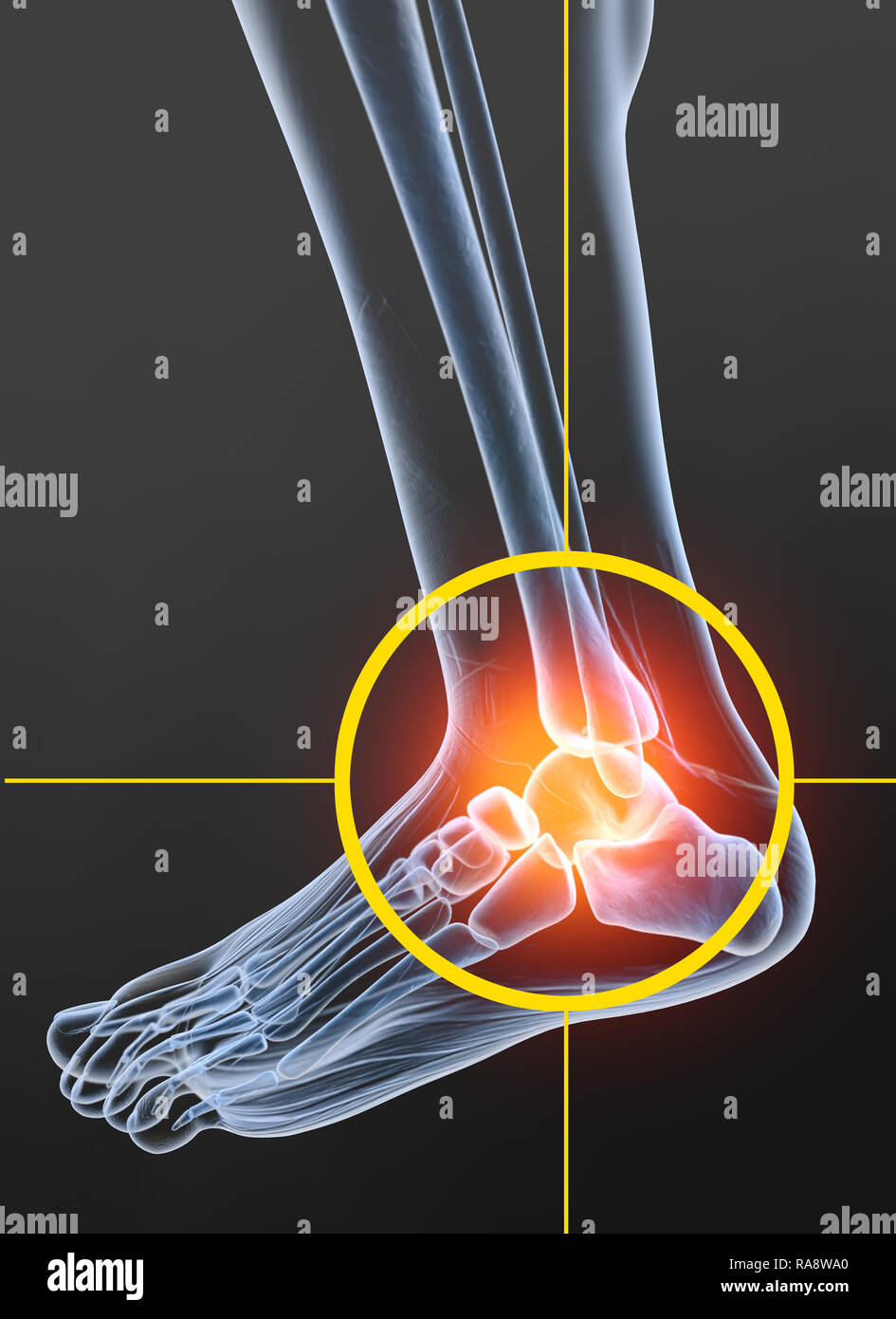 Ankle joint hi-res stock photography and images - Alamy