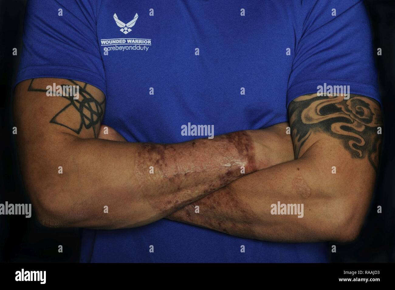 Shrapnel wounds hi-res stock photography and images - Alamy