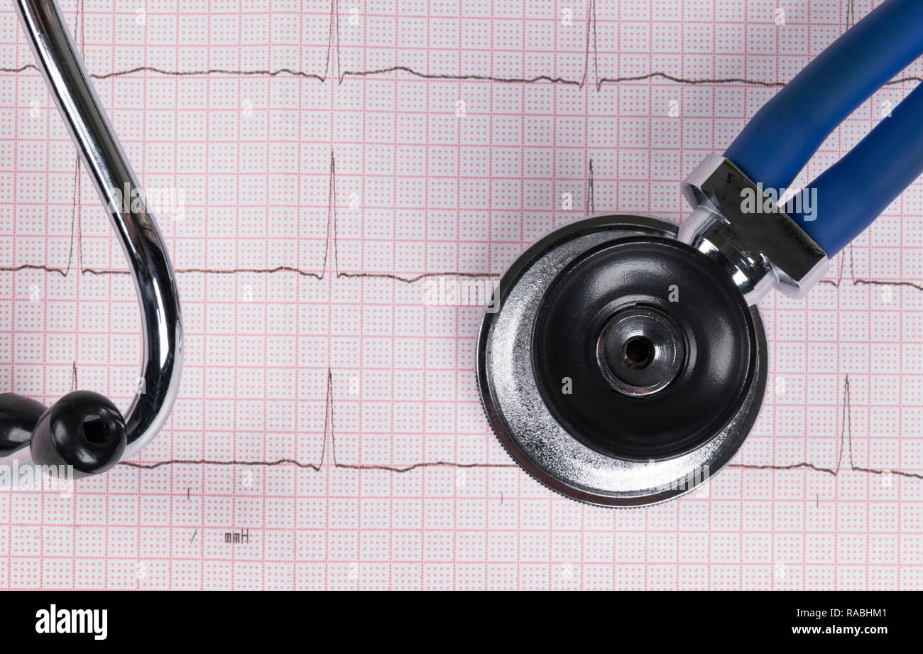 Stethoscope on the electrocardiogram (ECG) graph.Medicine concept ...