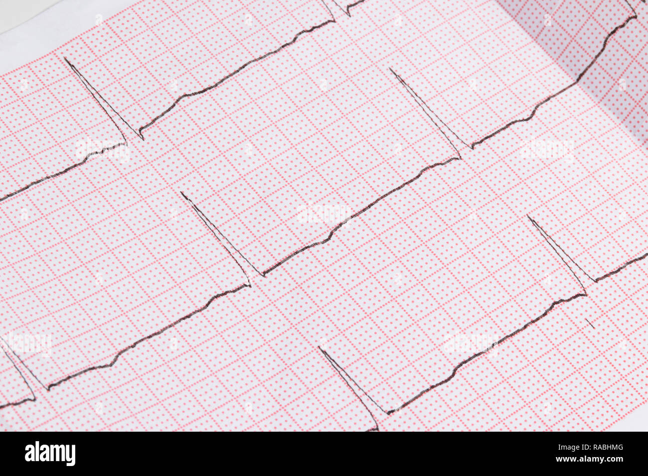 Close up of an electrocardiogram in paper form, medical healthcare ...
