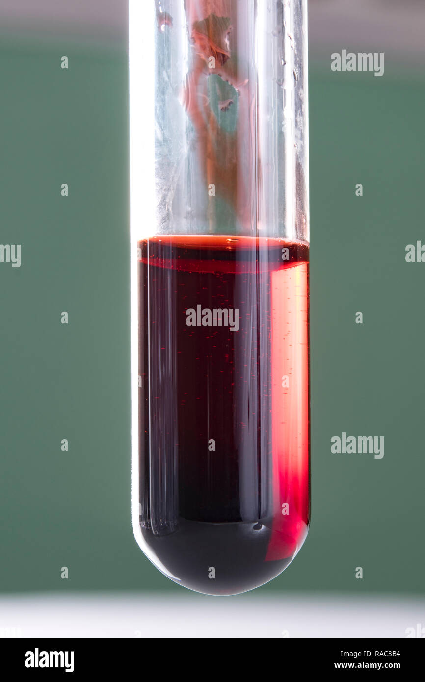 Blood test tube Stock Photo - Alamy