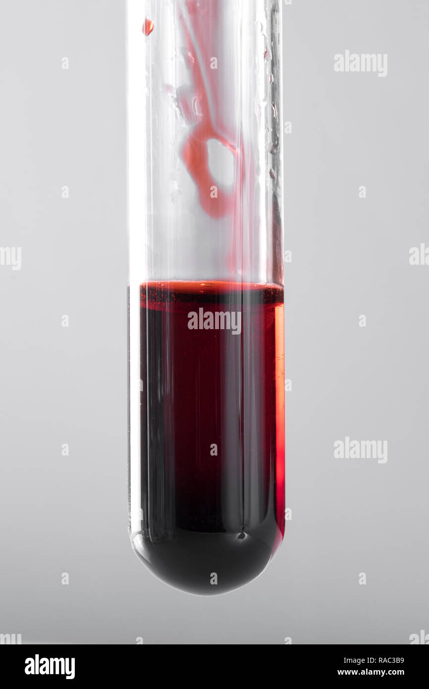 Blood test tube Stock Photo - Alamy
