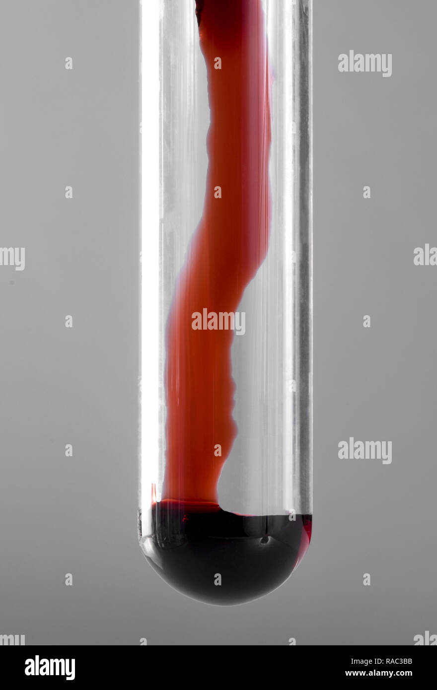 Blood test tube Stock Photo - Alamy