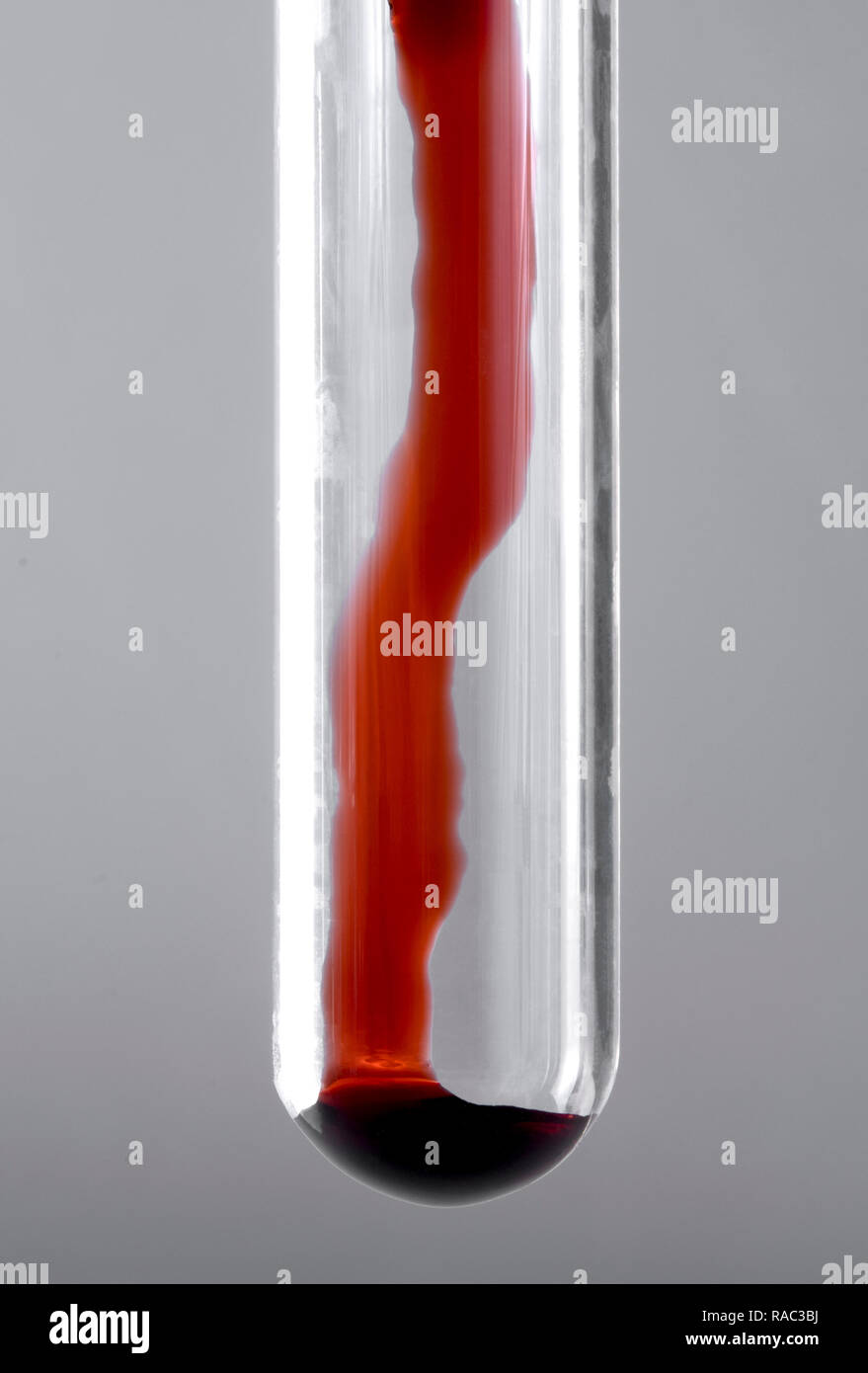 Blood test tube Stock Photo - Alamy