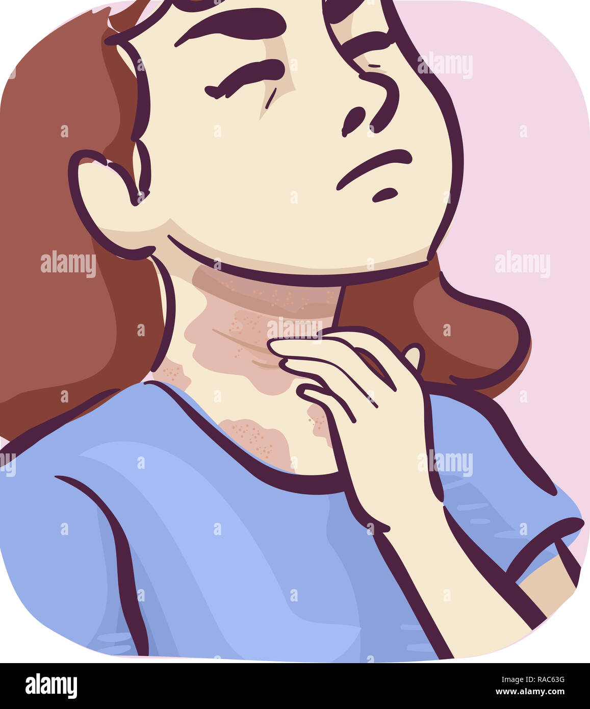 Illustration of a Girl with Rough, Darker and Itchy Skin on Her Neck ...