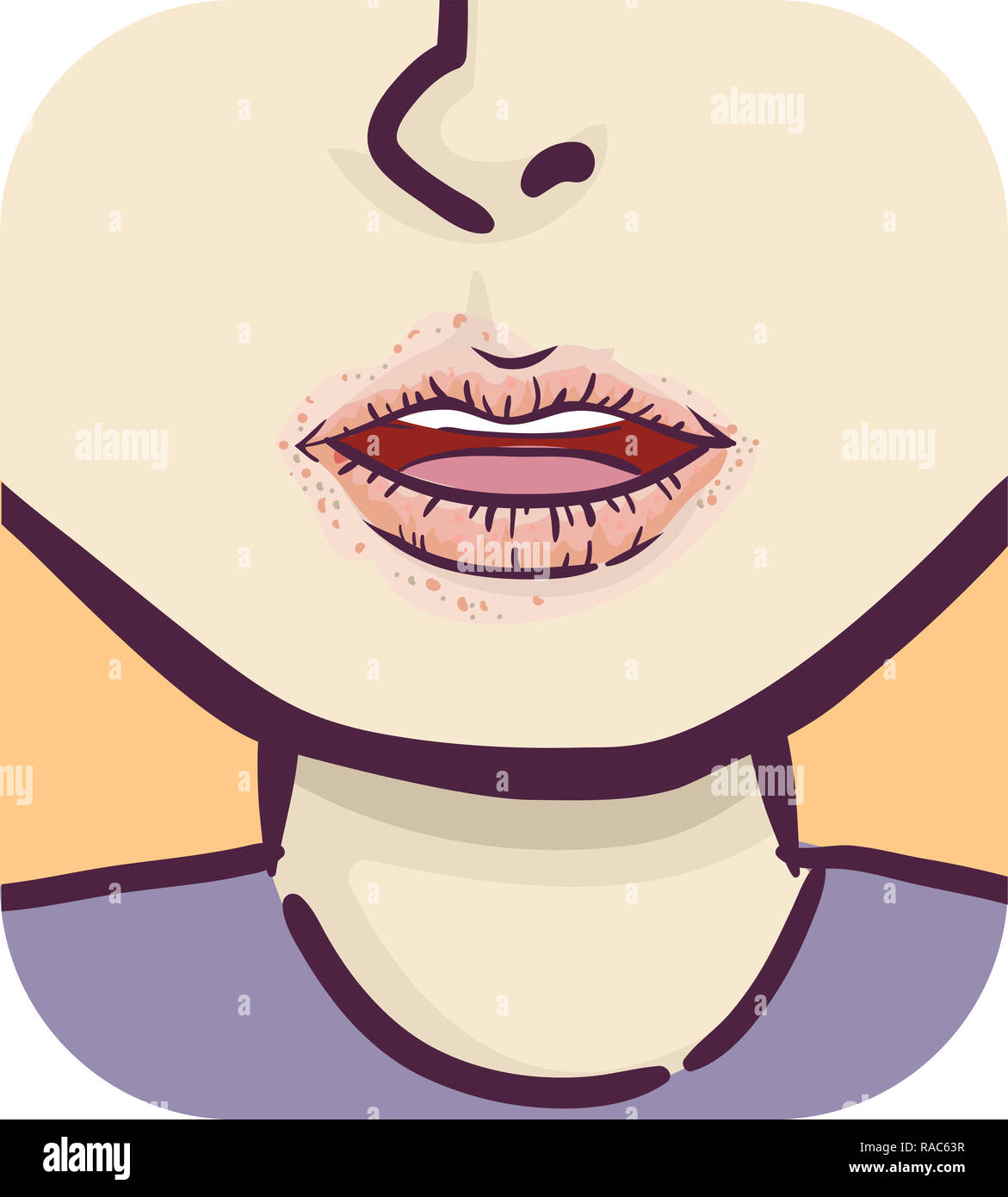 Illustration of a Girl with Dry Lips and Mouth Stock Photo - Alamy