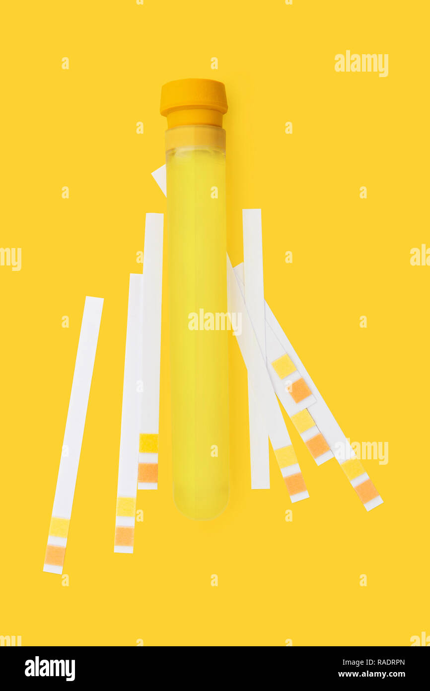 Biohacking background. Urine in test tube and ph test strip on yellow ...