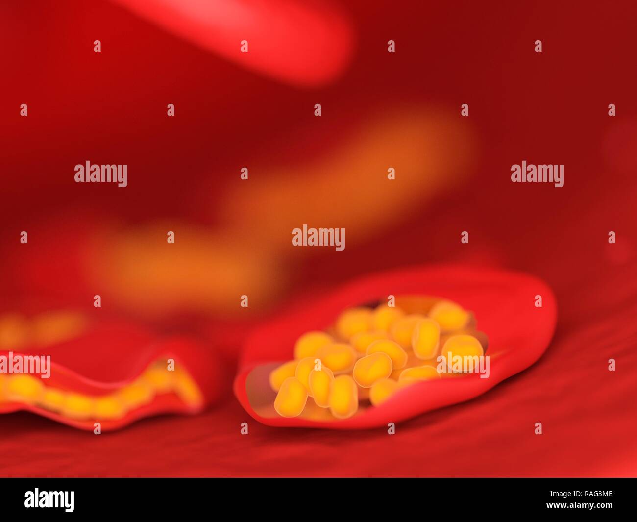 Illustration of malaria infected blood cells Stock Photo - Alamy