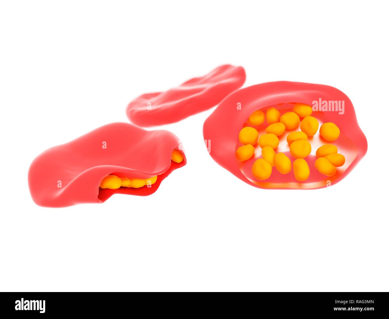 Illustration of malaria infected blood cells Stock Photo - Alamy