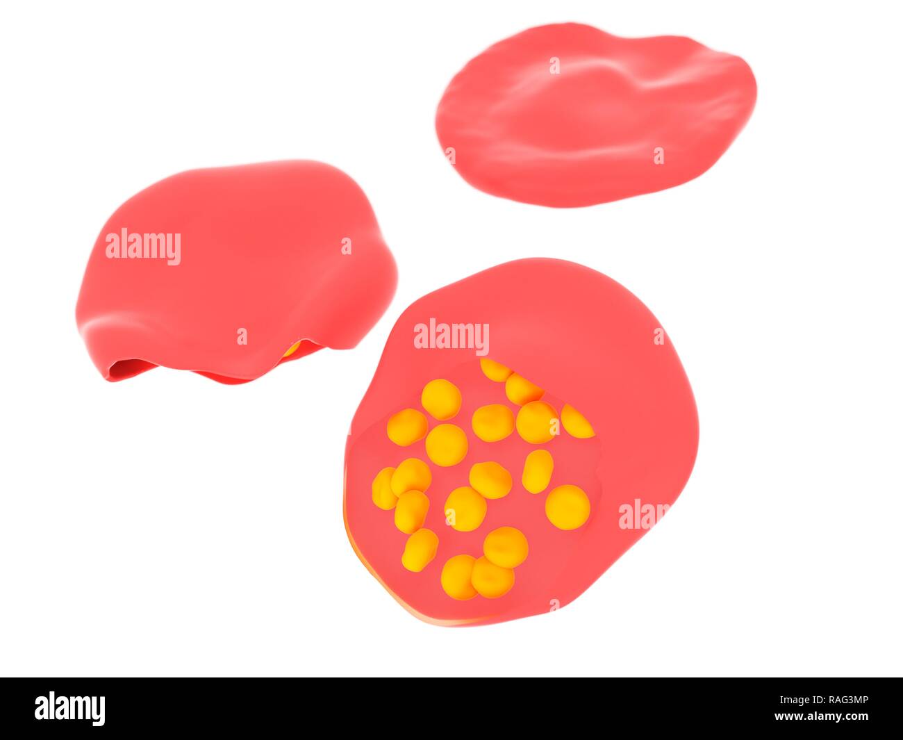 Illustration of malaria infected blood cells Stock Photo - Alamy