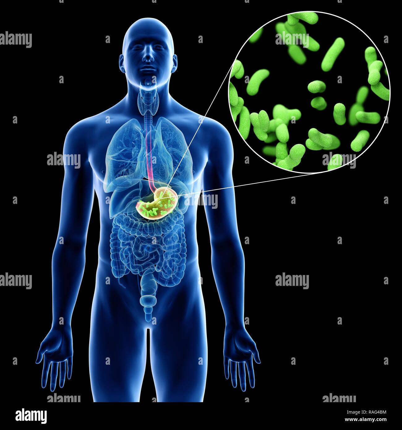 Illustration of a man's stomach infection Stock Photo - Alamy
