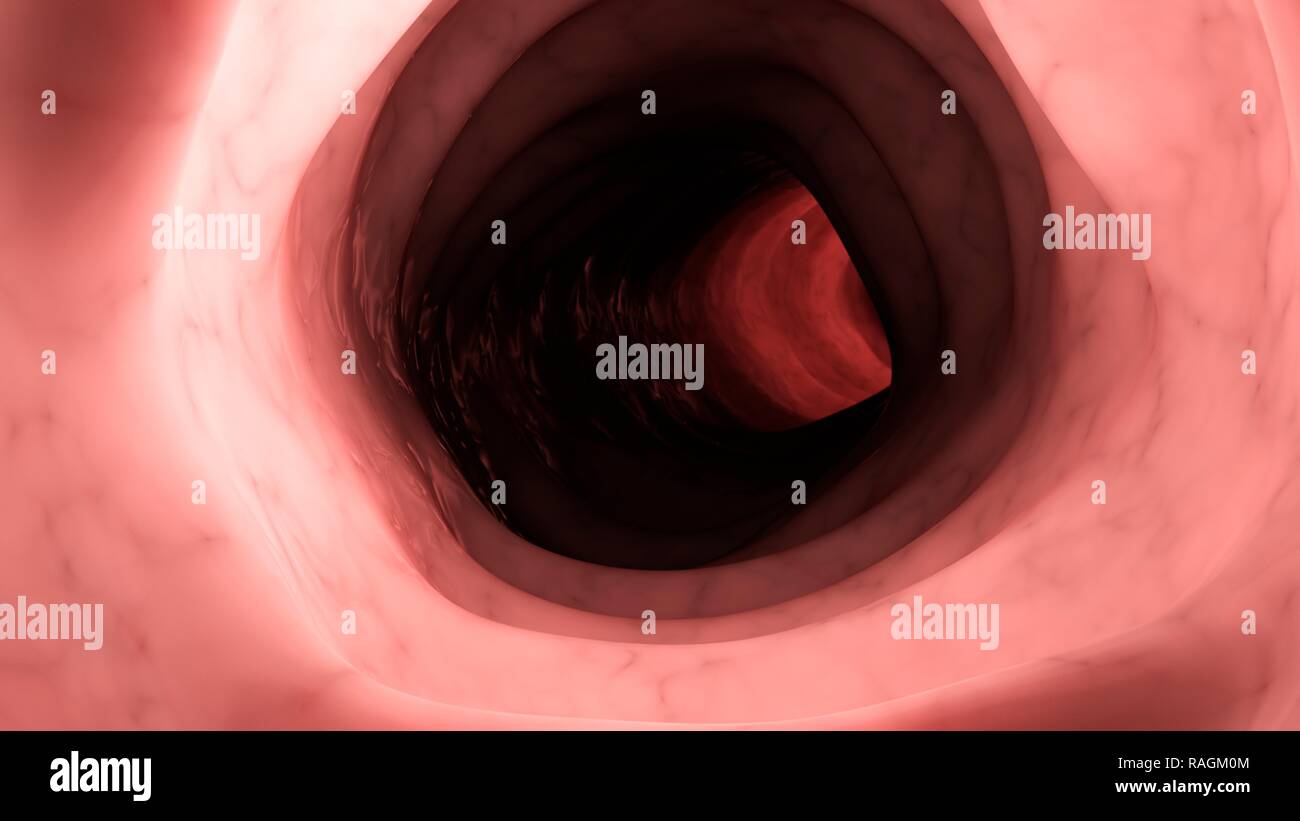 Illustration of a healthy human colon from inside Stock Photo - Alamy