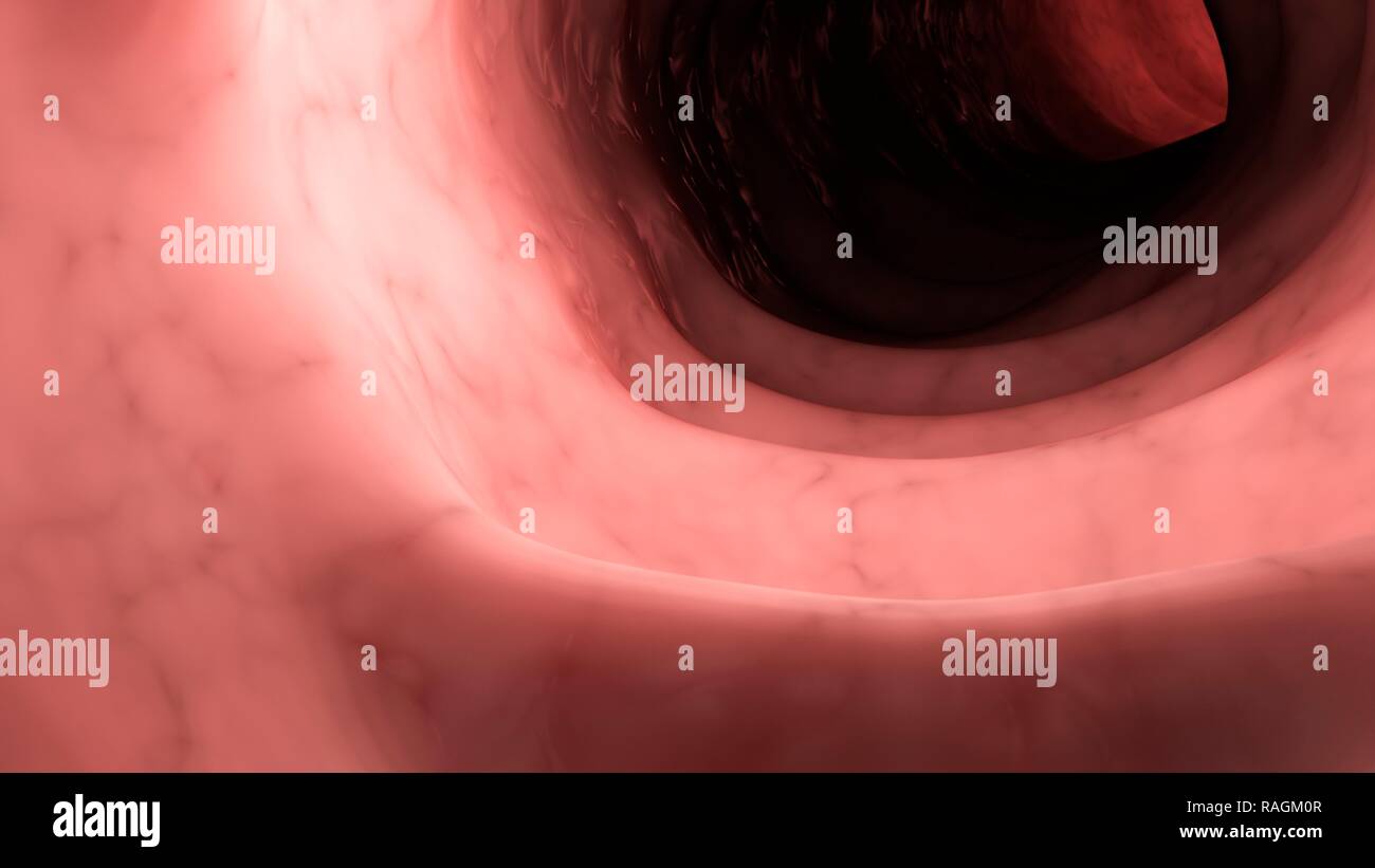 Illustration of a healthy human colon from inside Stock Photo - Alamy