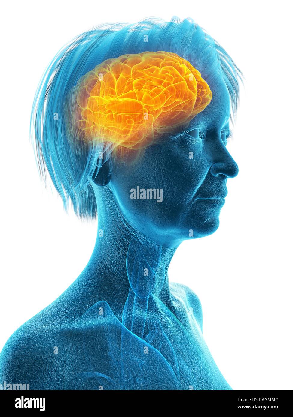 Illustration of an old woman's brain Stock Photo - Alamy