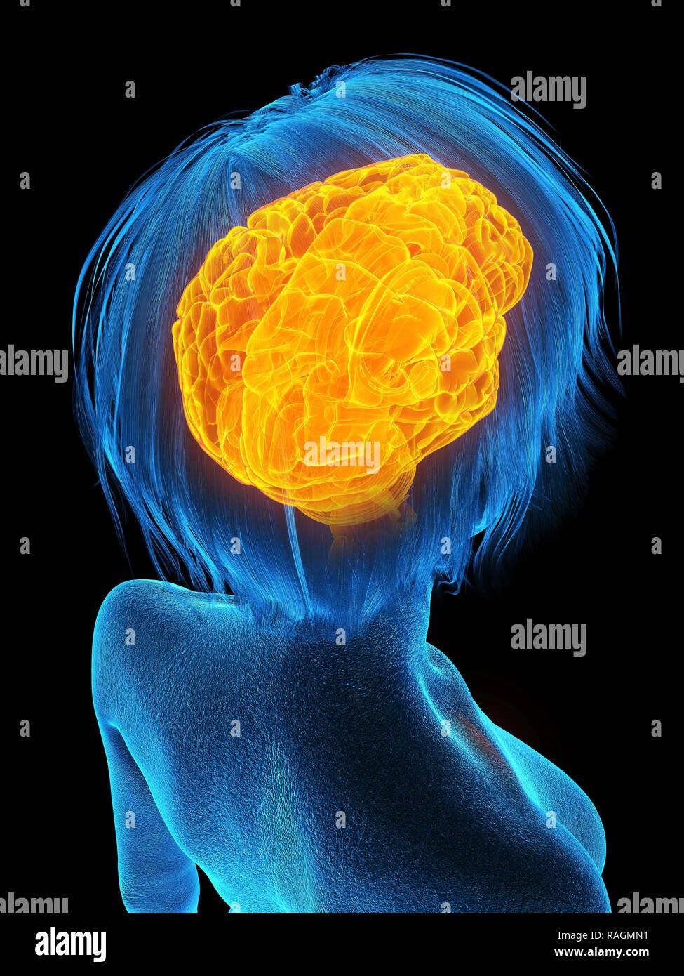 Illustration of an old woman's brain Stock Photo - Alamy