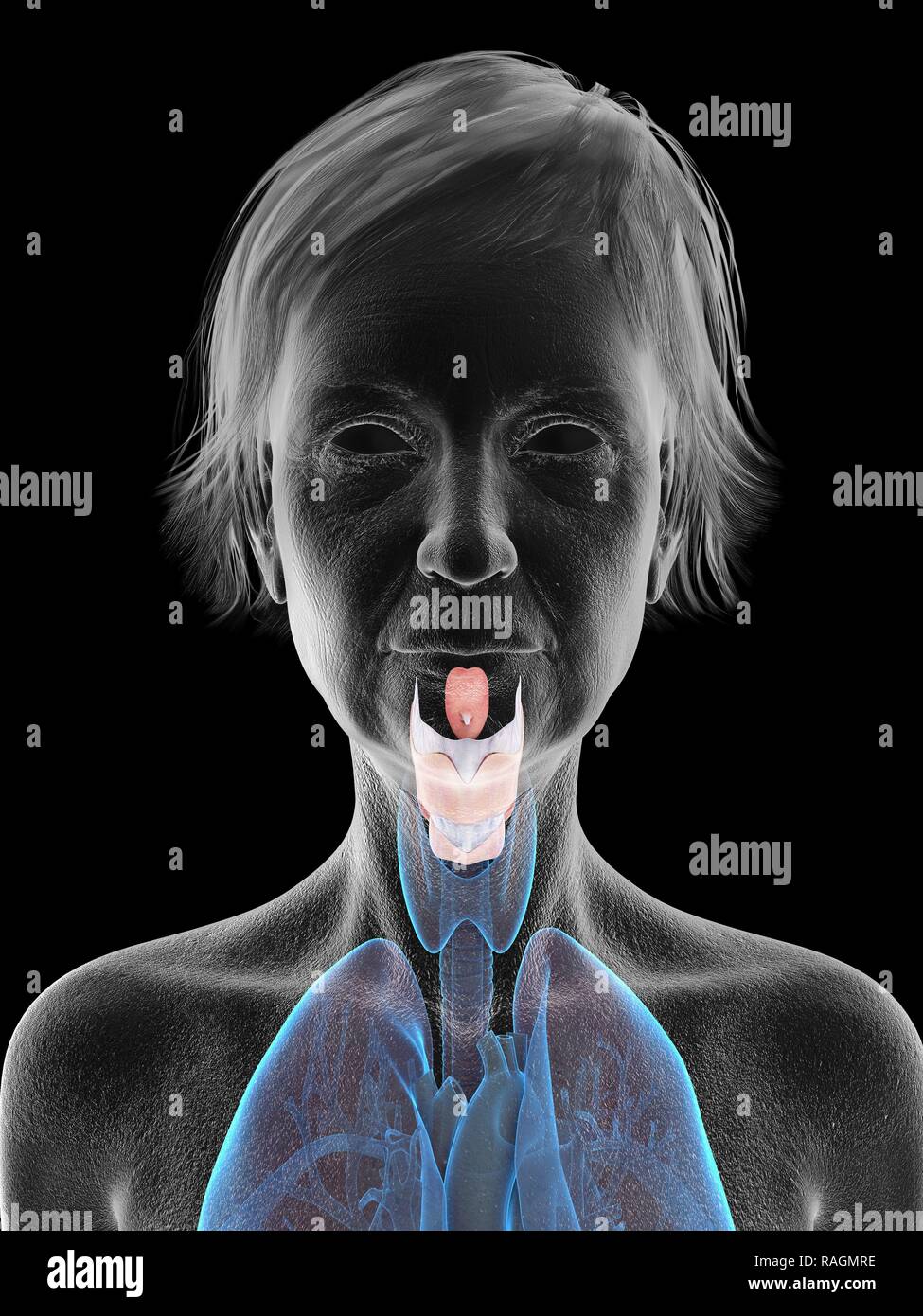 Illustration of an old woman's larynx Stock Photo - Alamy