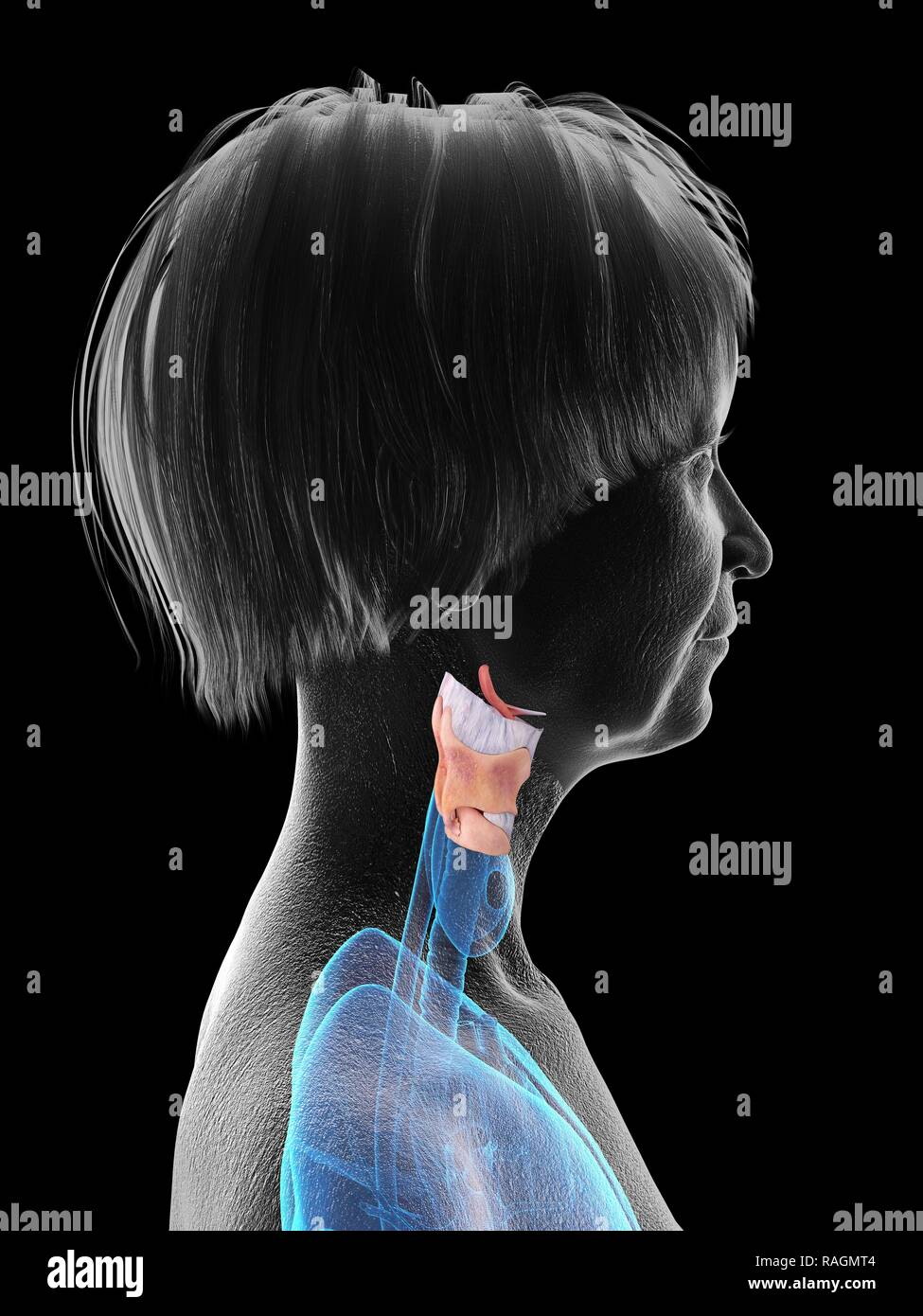 Illustration of an old woman's larynx Stock Photo - Alamy