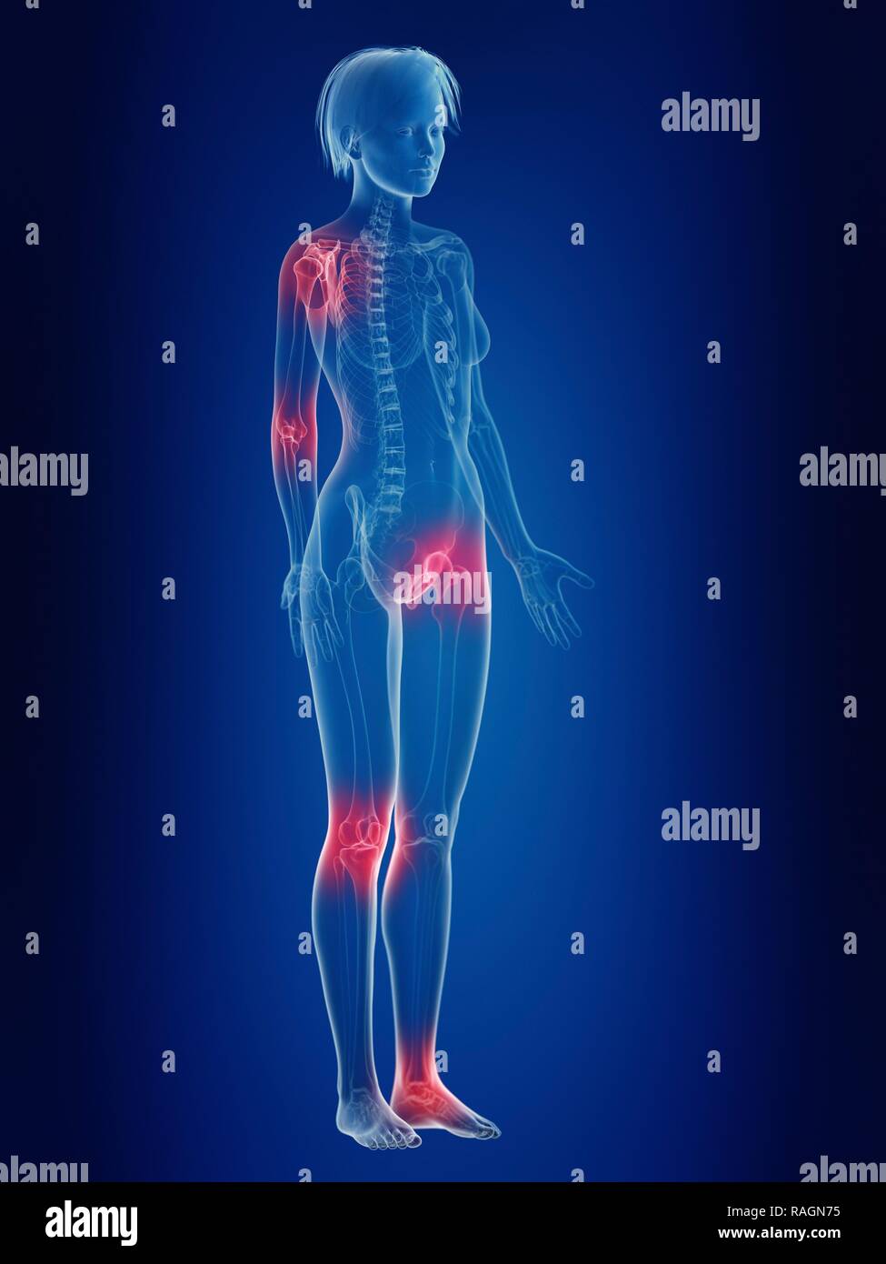 Illustration of a woman's painful joints Stock Photo - Alamy