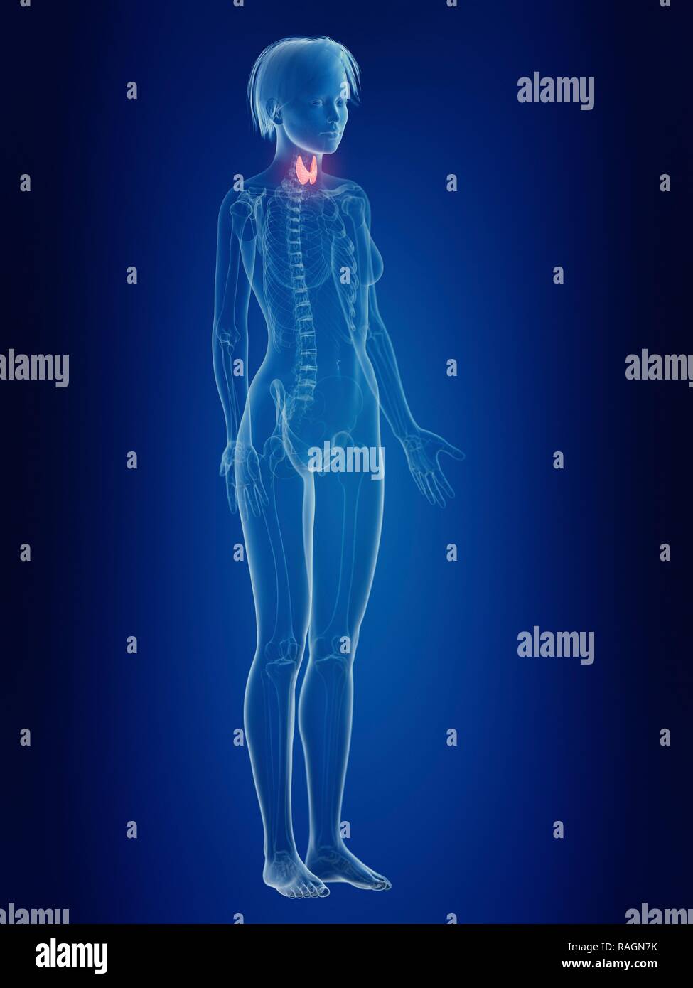 Illustration of a woman's inflamed thyroid gland Stock Photo - Alamy